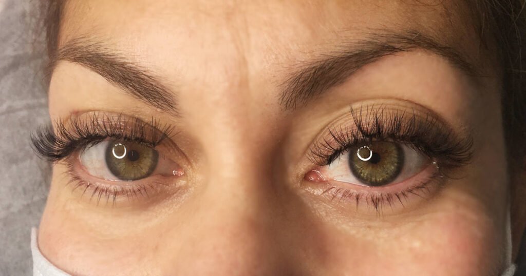 What Are Protruding Eyes - Here We Have Your Answers