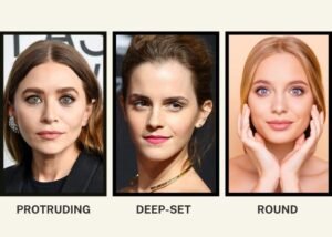 What Are Protruding Eyes - Here We Have Your Answers