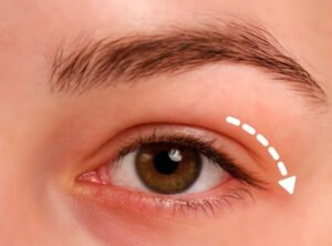 Do I Have Downturned Eyes - Unsure? We're Here For You