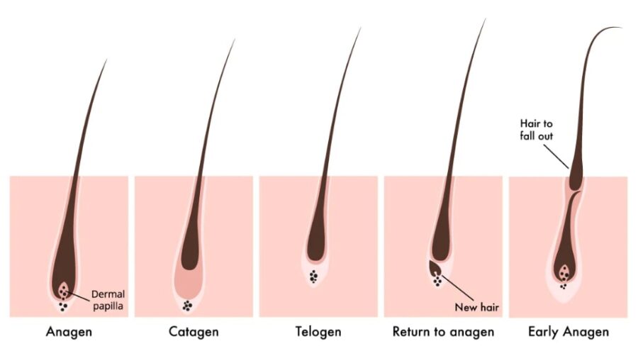 Why Are My Eyelashes Straight? What Should I Do?
