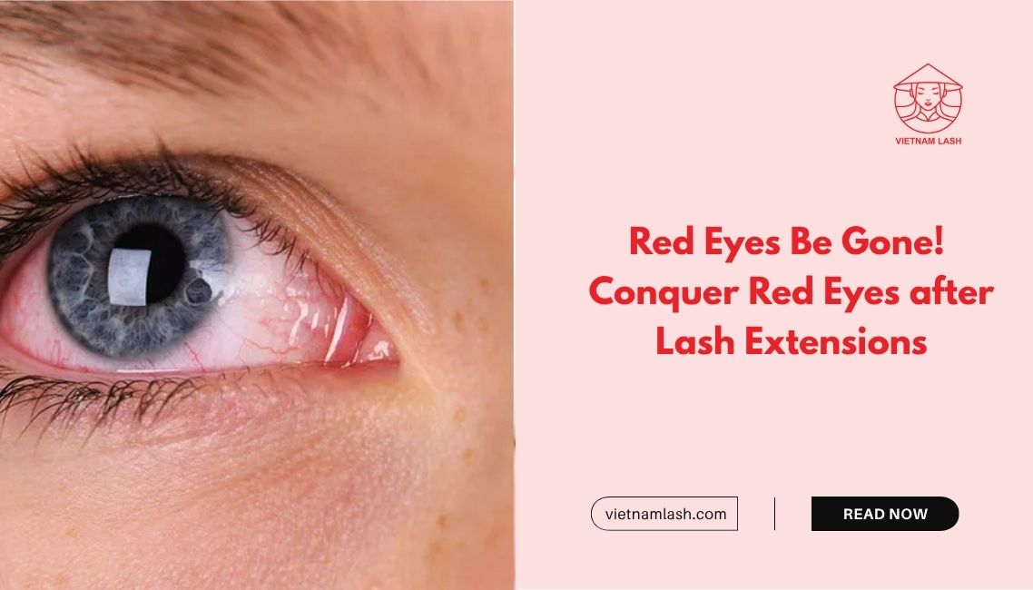 What Are Upturned Eyes - Easy Since You Got Here